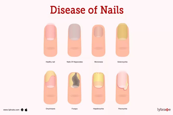 Nail Problems & Health 1-Minute Check | MAESTROUSA